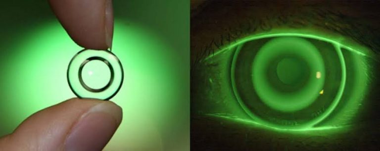 Spectacles and Contact lenses – Myopia Treatment - Optography