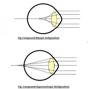 Types of ASTIGMATISM - Optography