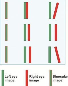 Diplopia (Double Vision) Physiological and pathological - Optography