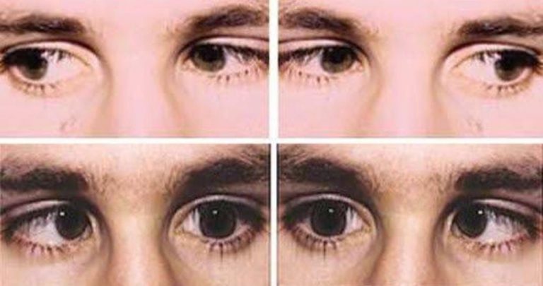 EXOPHORIA - Optography