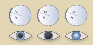 FITTING PROCEDURE FOR RIGID CONTACT LENS - Optography