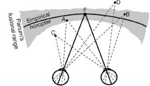 ARC (ABNORMAL RETINAL CORRESPONDENCE) - Optography