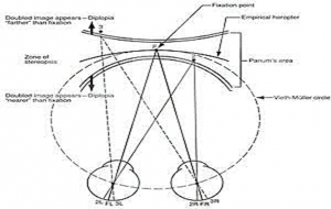 ARC (ABNORMAL RETINAL CORRESPONDENCE) - Optography