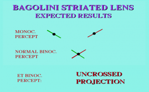 ARC (ABNORMAL RETINAL CORRESPONDENCE) - Optography