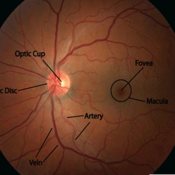 POTENTIAL ACUITY METER - Optography