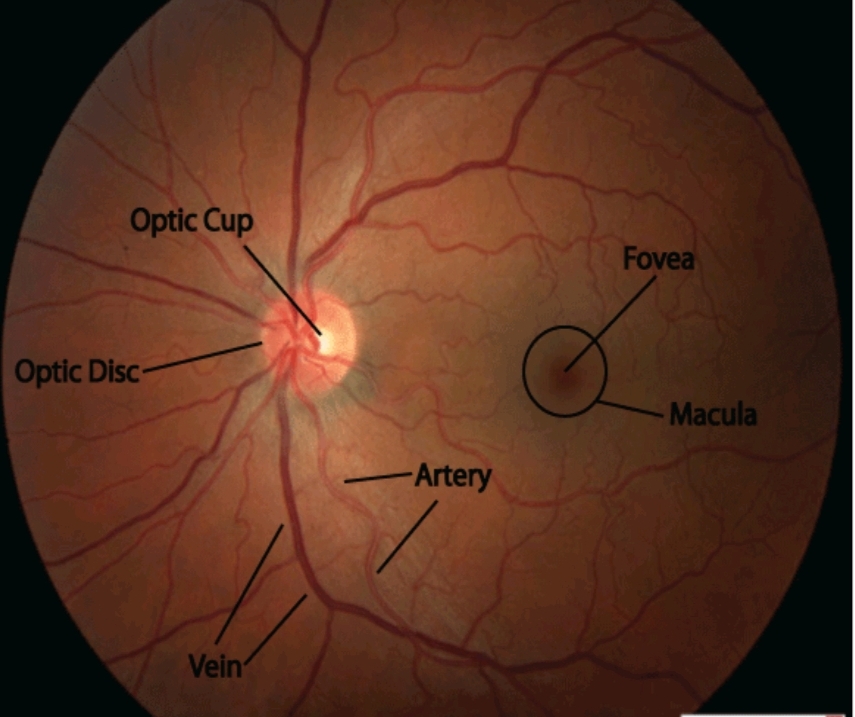 STREAK RETINOSCOPY Optography