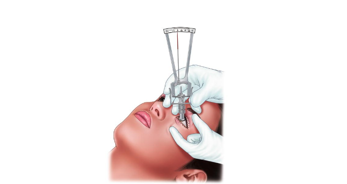 Describe briefly about Tonometry - Optography