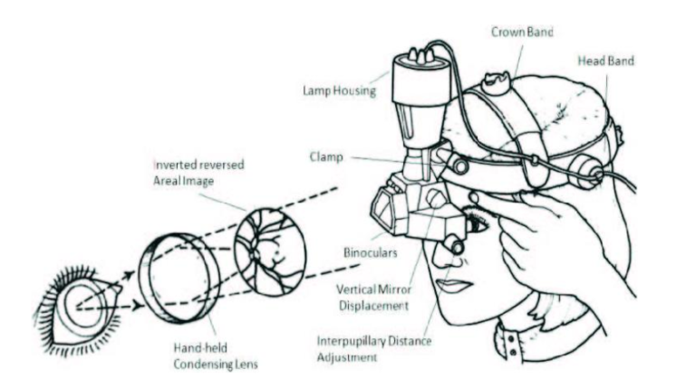 POTENTIAL ACUITY METER - Optography